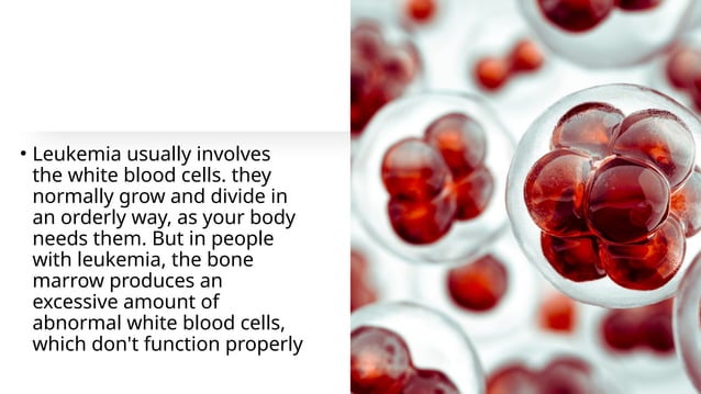 LEUKEMIA.pptx diagnosis and treatment of | PPTX