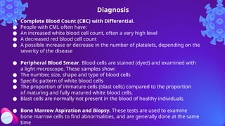 Leukemia.pptx histology ….lllllll chronic myeloid leukemia | PPTX