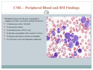 Leukemia-ppt | PPT
