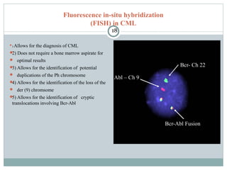 Leukemia-ppt | PPT