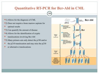 Leukemia-ppt | PPT