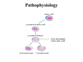 Acute Lymphocytic Leukemia | PPTX