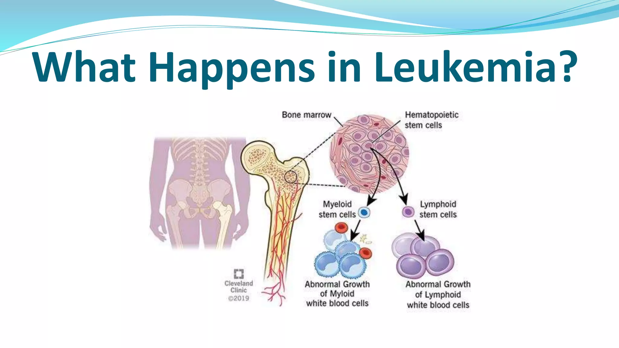 Leukemia and its types presentation 1 | PPTX