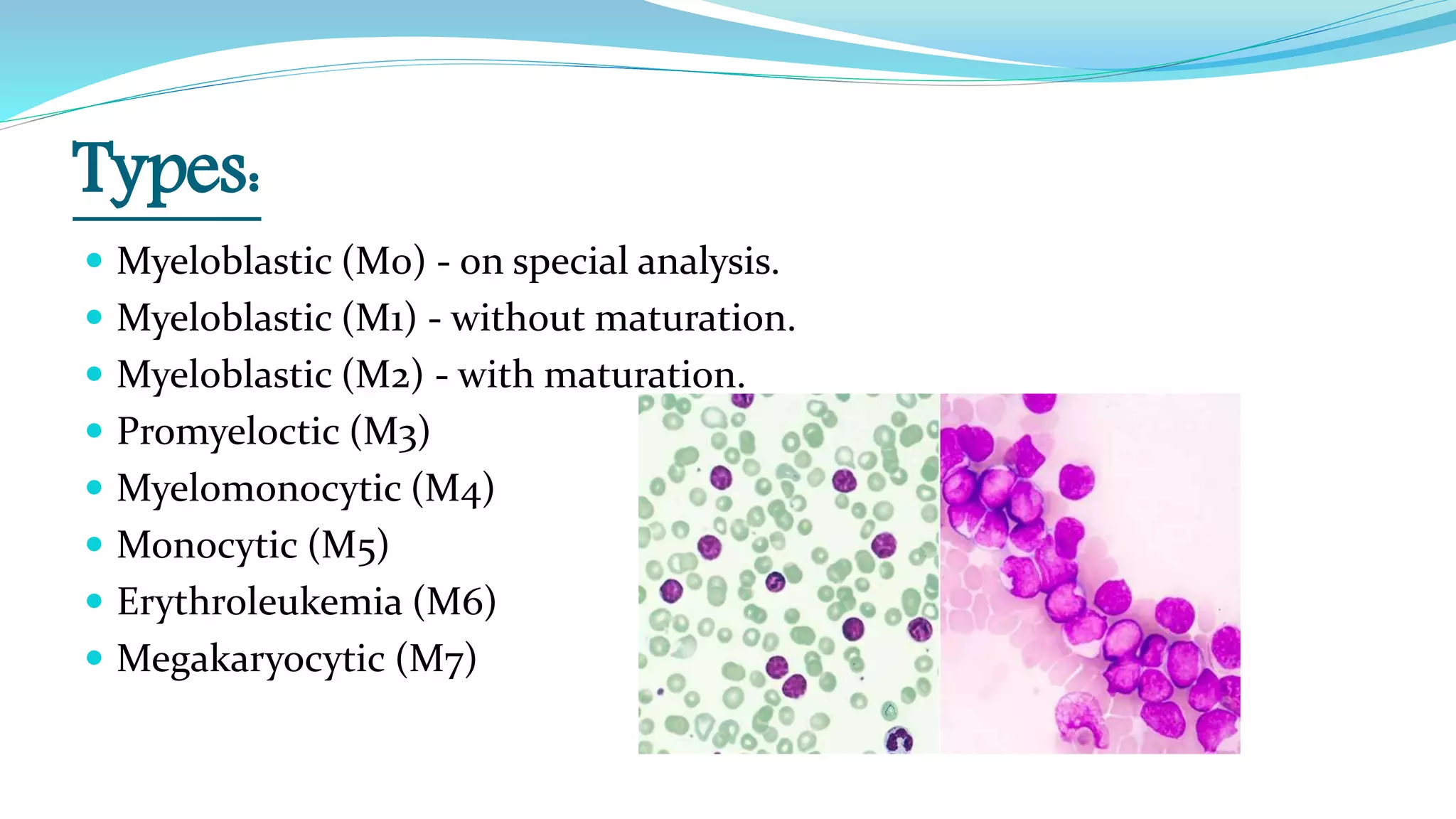 Leukemia and its types presentation 1 | PPTX