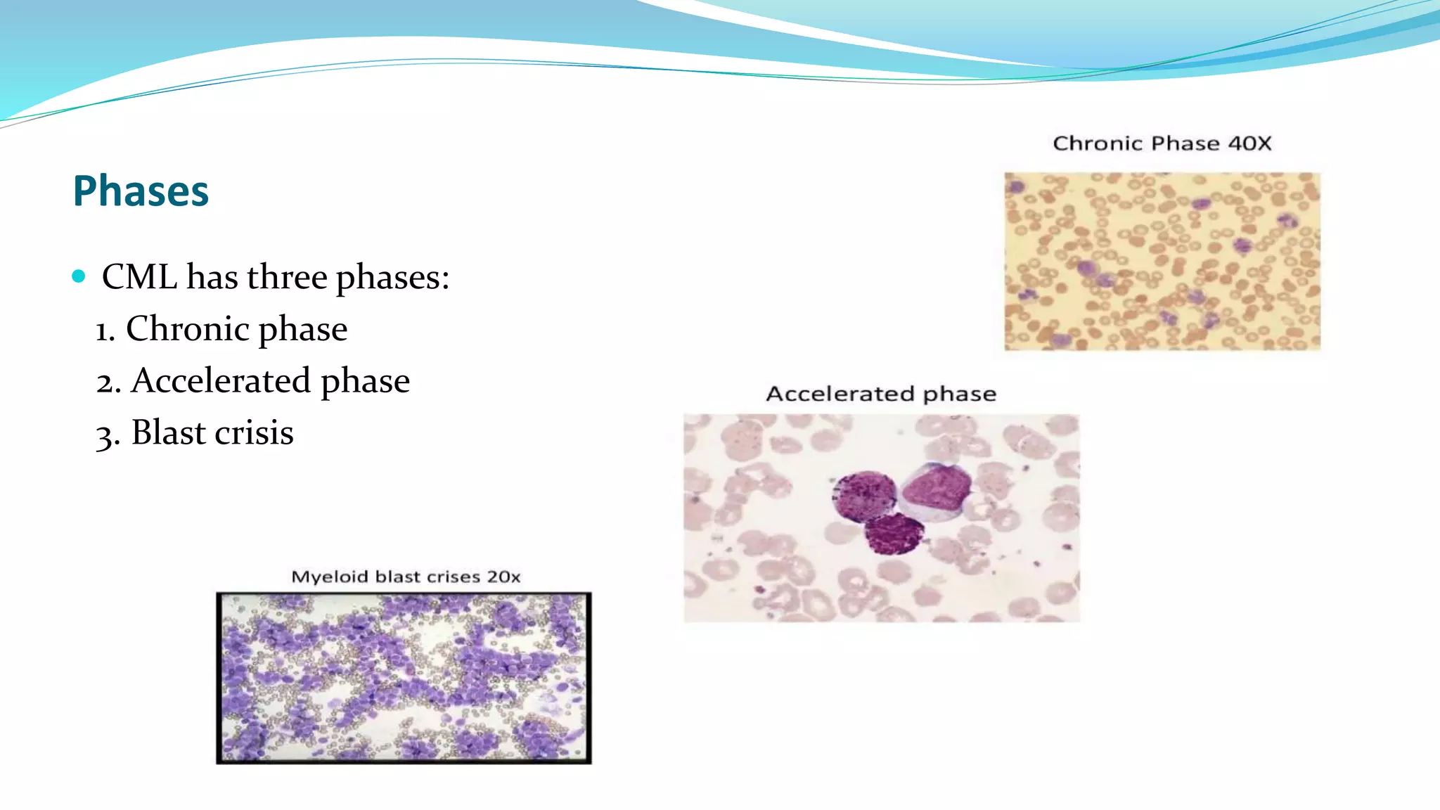 Leukemia and its types presentation 1 | PPTX