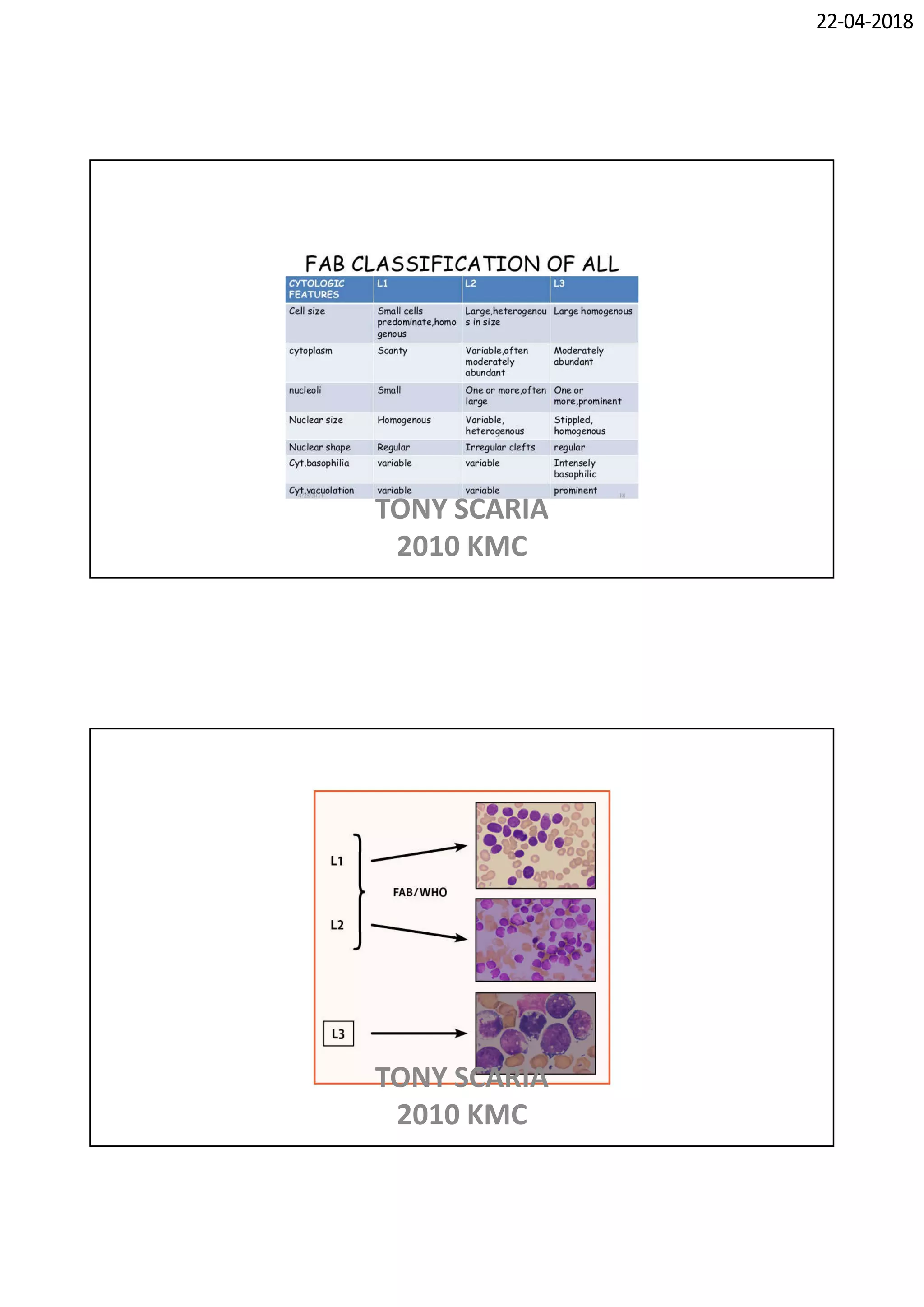 Leukemia and lymphoma PATHOLOGY REVISION NOTES | PDF