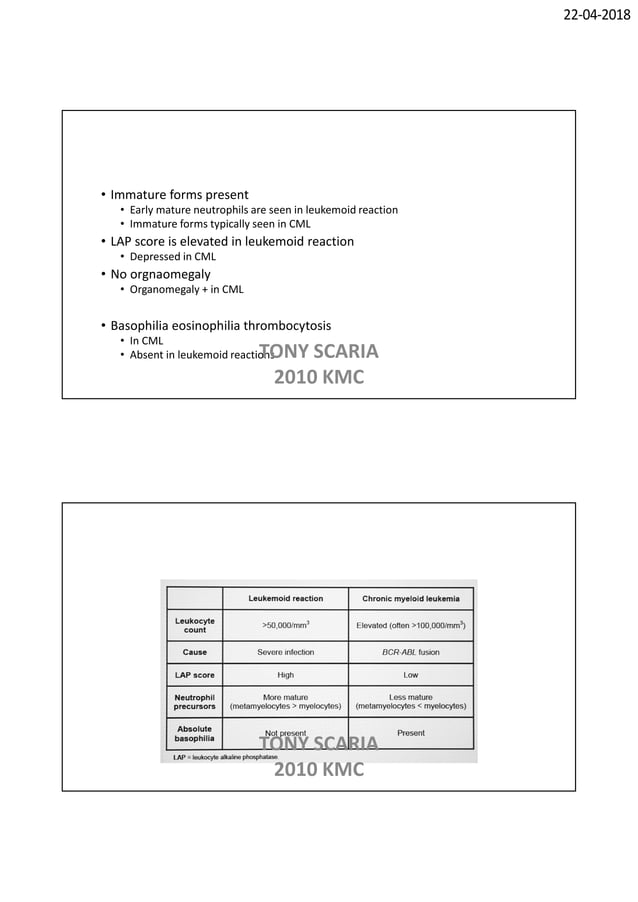 Leukemia and lymphoma PATHOLOGY REVISION NOTES | PDF