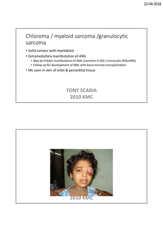 Leukemia and lymphoma PATHOLOGY REVISION NOTES | PDF