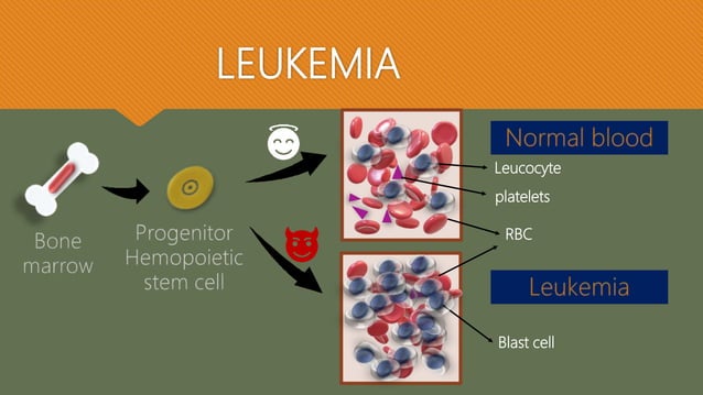 Leukemia in children | PPTX