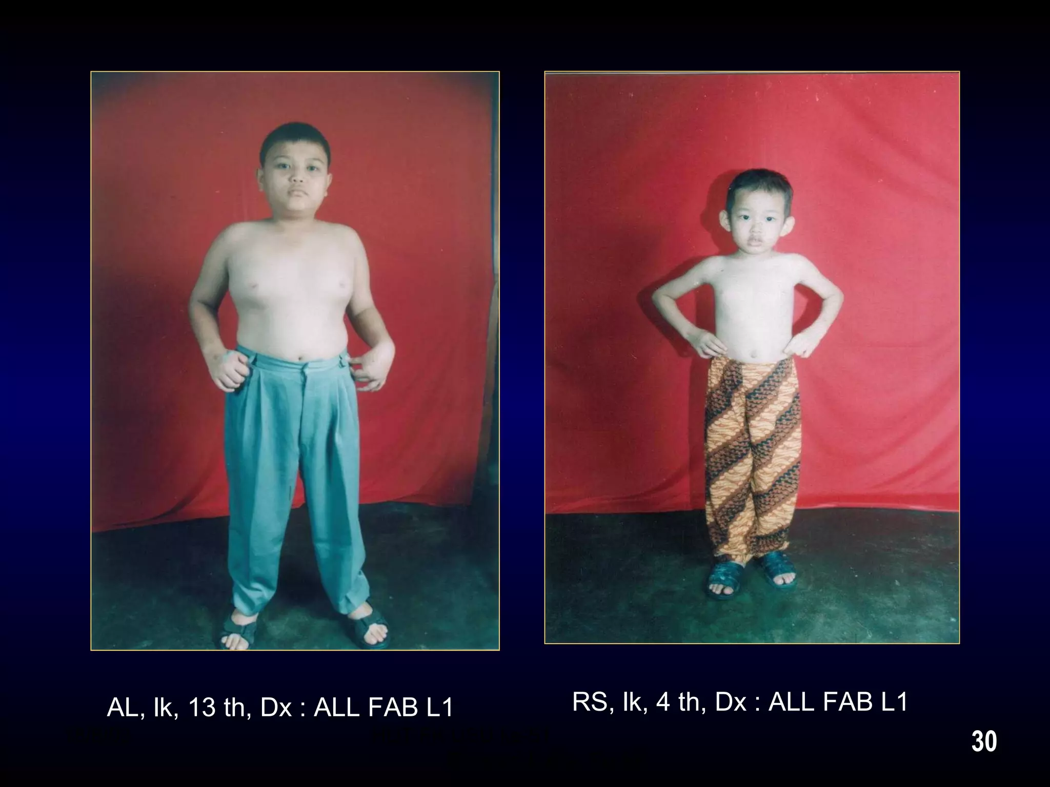 Leukemia pada anak 1 | PPT