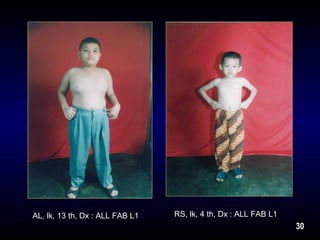 Leukemia pada anak 1 | PPT