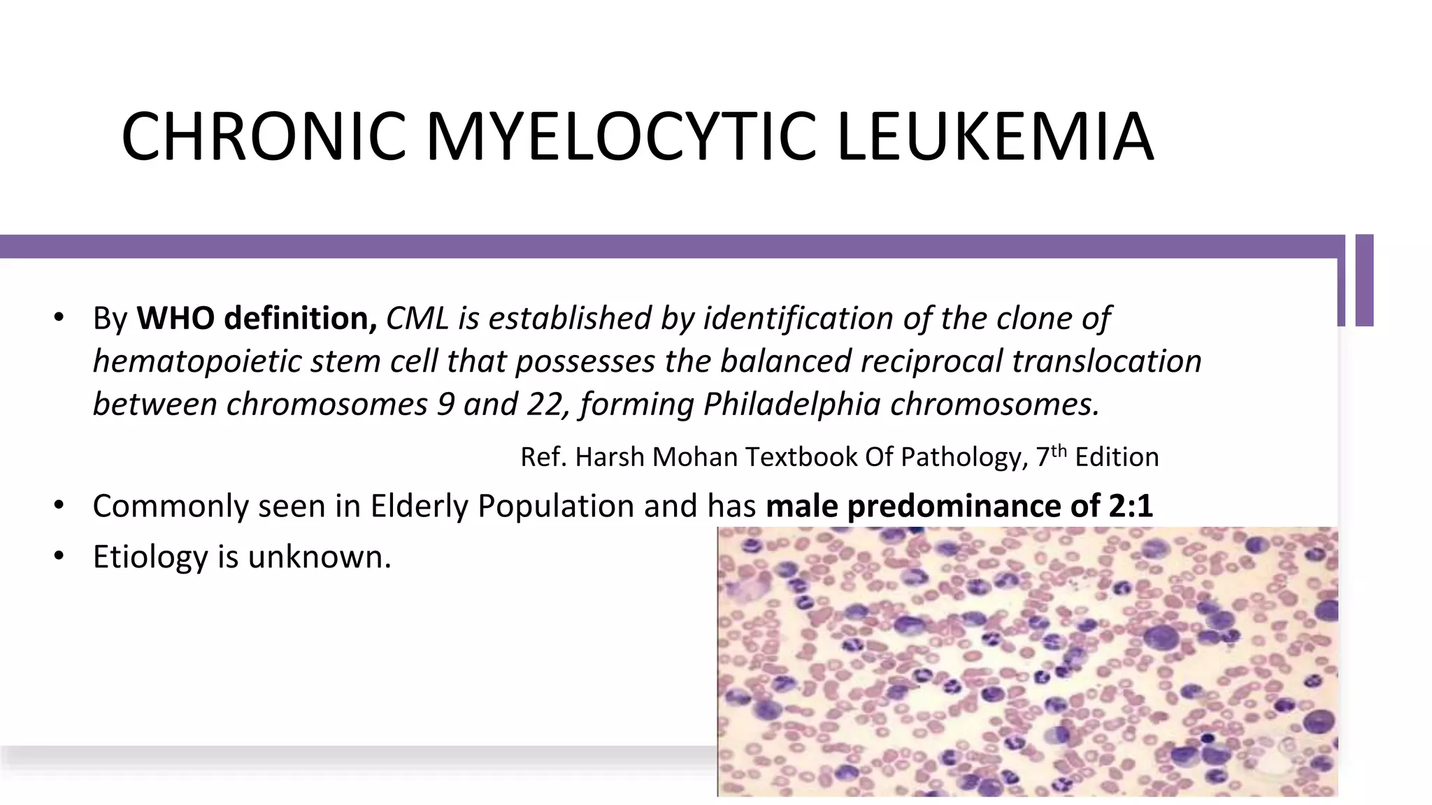 Leukemia presentation | PPT