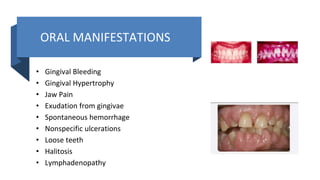 Leukemia presentation | PPT