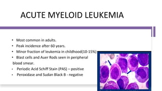 Leukemia presentation | PPT