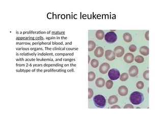 Leukemias. A integral part of hematology | PPTX