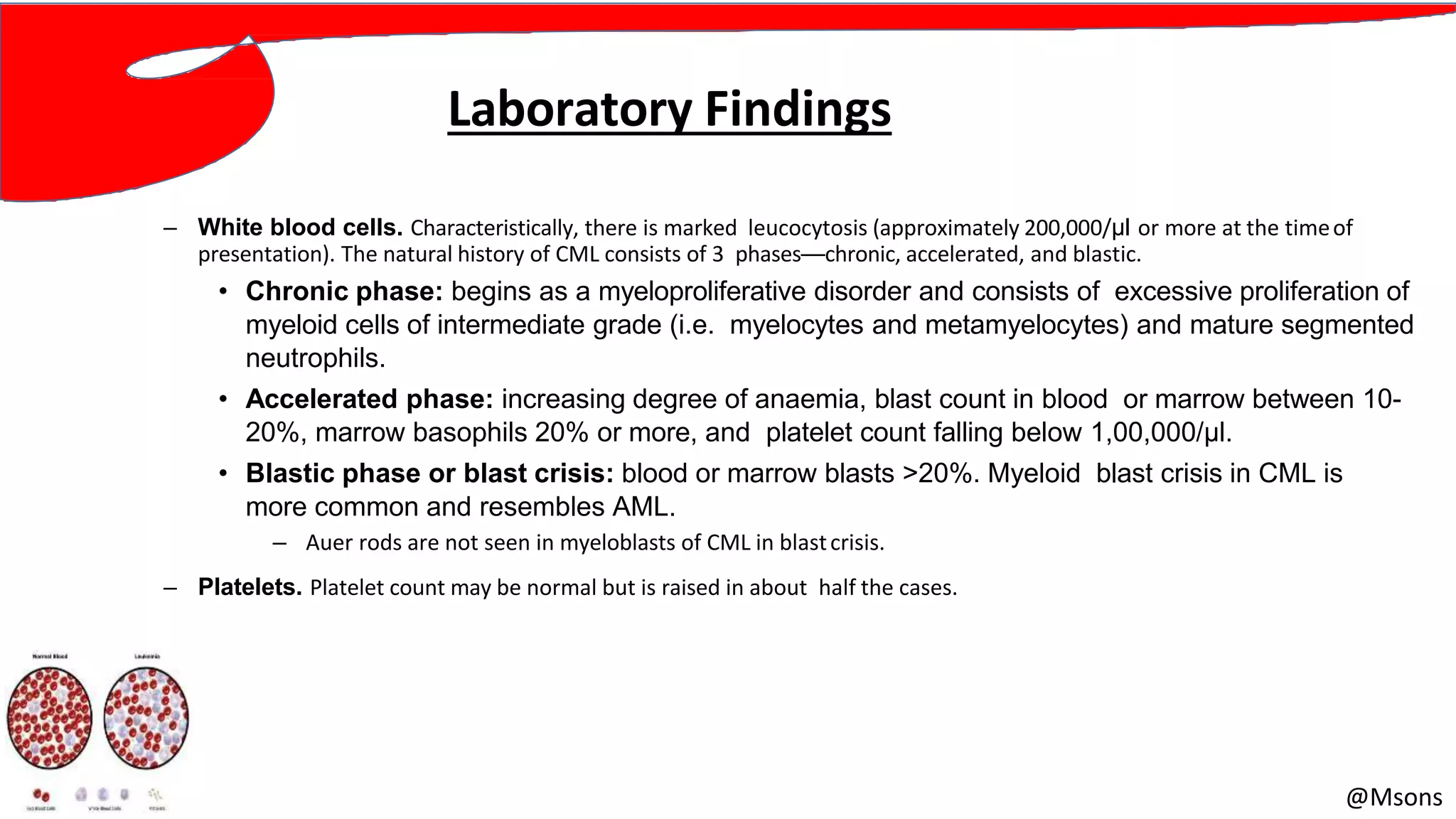 Leukemia slides pathology 4th year mbbs | PPTX