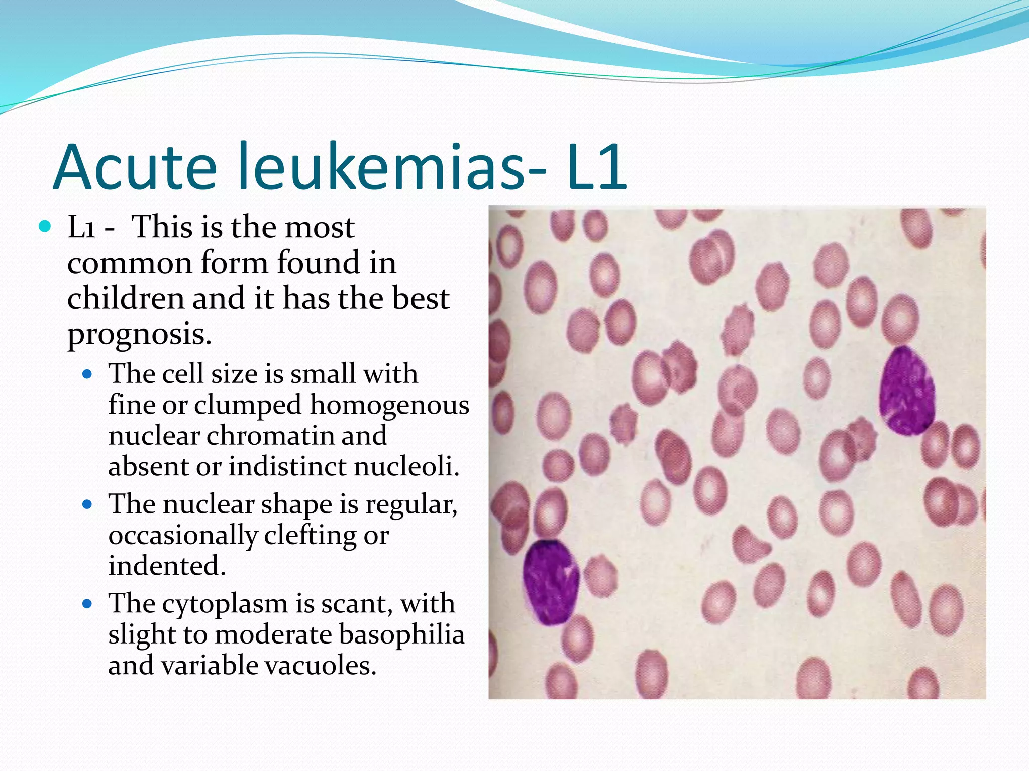 Leukemia | PPTX