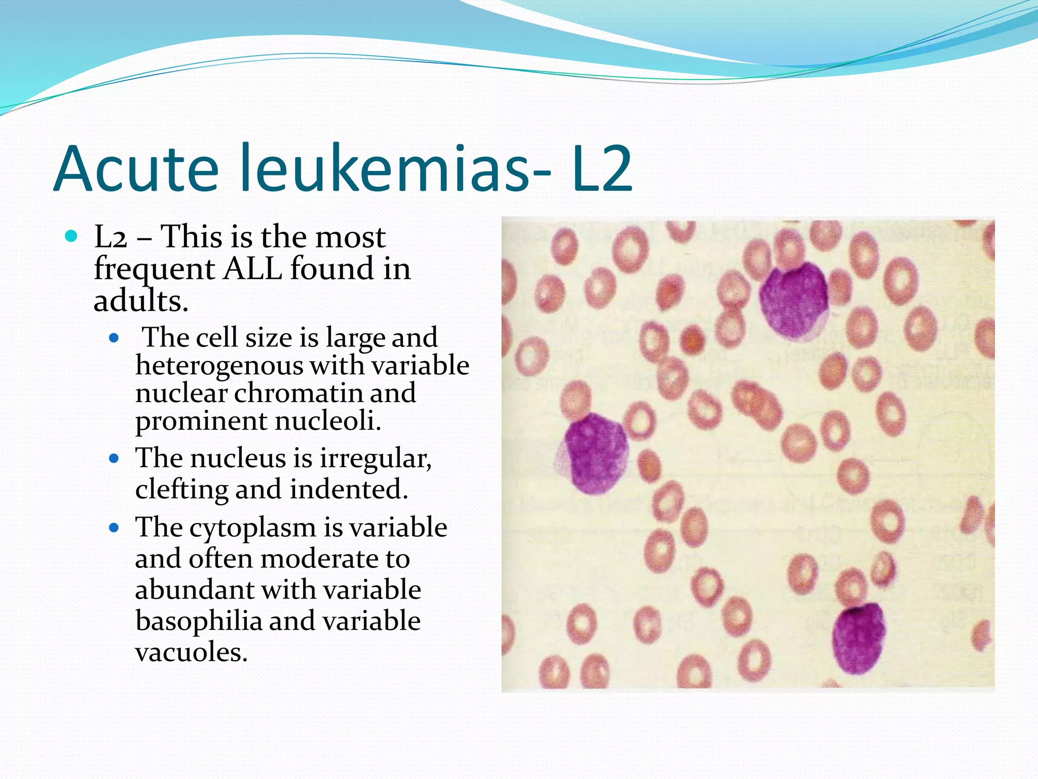 Leukemia | PPTX