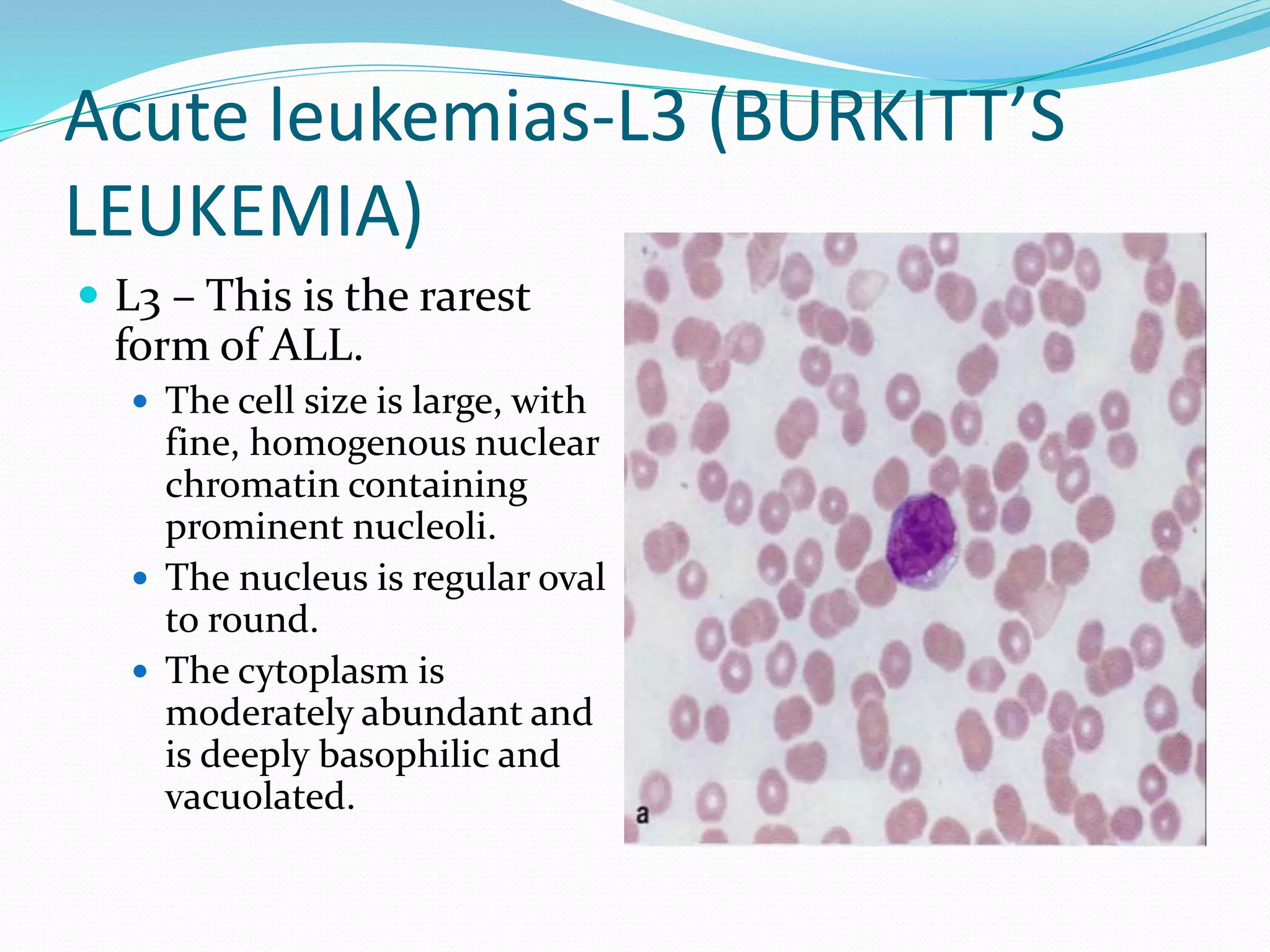 Leukemia | PPTX
