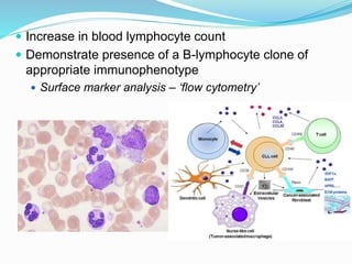 Leukemia | PPTX