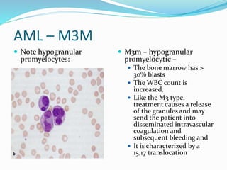 Leukemia | PPTX