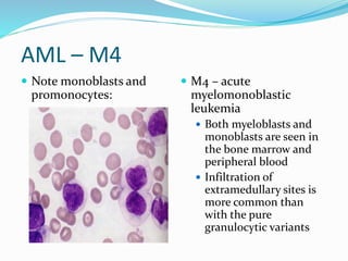 Table III From Classification Of Cell Types In Acute, 54% OFF