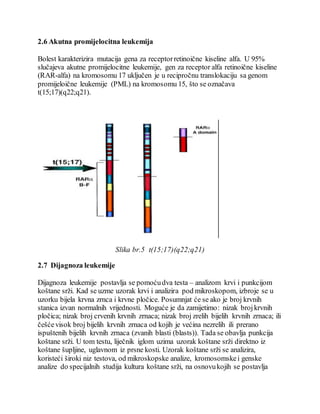 Leukemija | DOCX