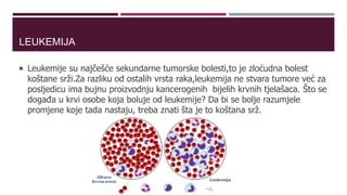 Leukemija | PPTX