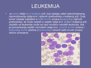 Leukemija Dunja Fridman | PPT