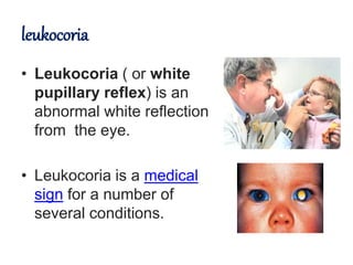 Leukocoria (White Pupillary Reflex) | PPTX
