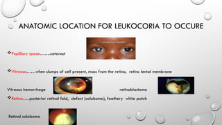 LEUKOCORIA causes ,risk factors and treatment.pptx
