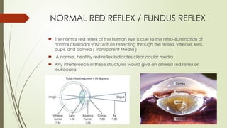 Leukocoria in children in ophthalmology. | PPTX