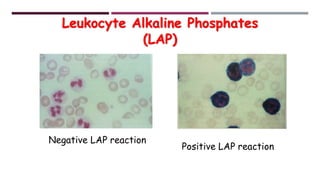 Leukocyte Alkaline Phosphatase Stain | PDF
