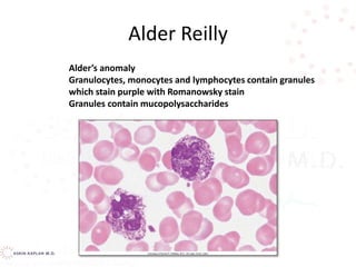 Alder Reilly Anomaly