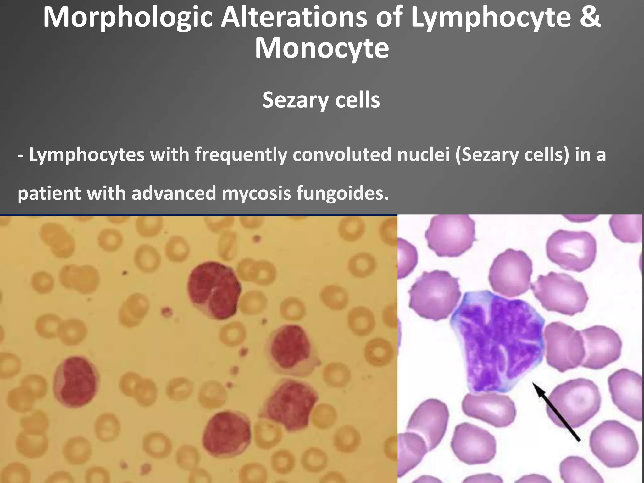 Leukocytes - Advance Hematology | PPTX