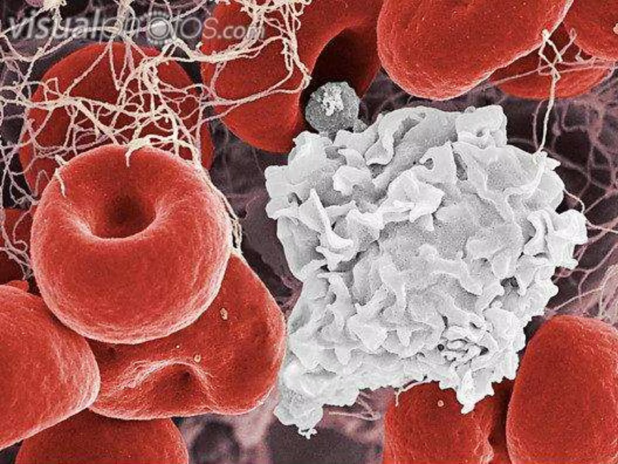 Leukocytes - Advance Hematology | PPTX