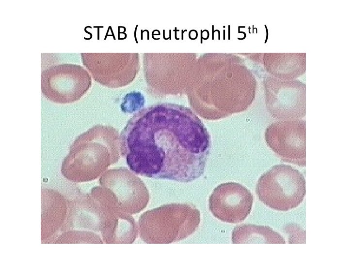 Leukopiesis and agranulositosis 2011