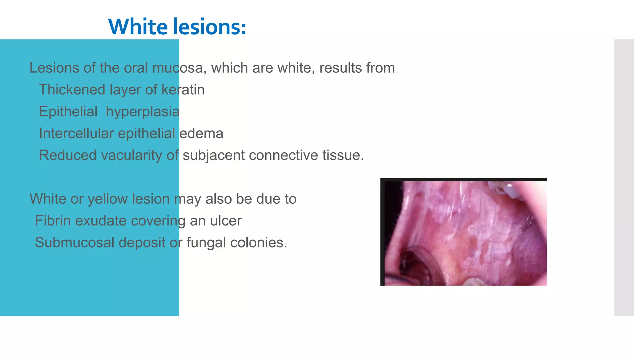 Pre cancerous lesion and condition | PPTX