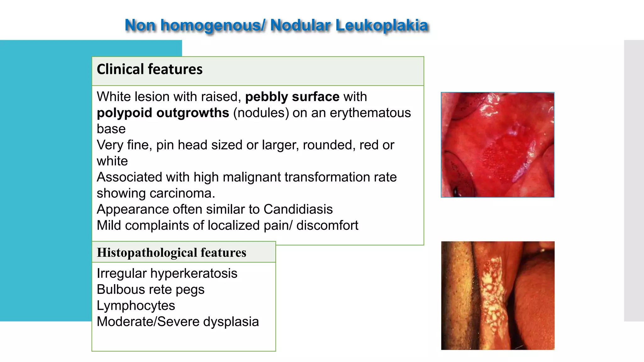 Pre cancerous lesion and condition | PPTX