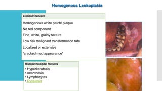 Pre cancerous lesion and condition | PPTX