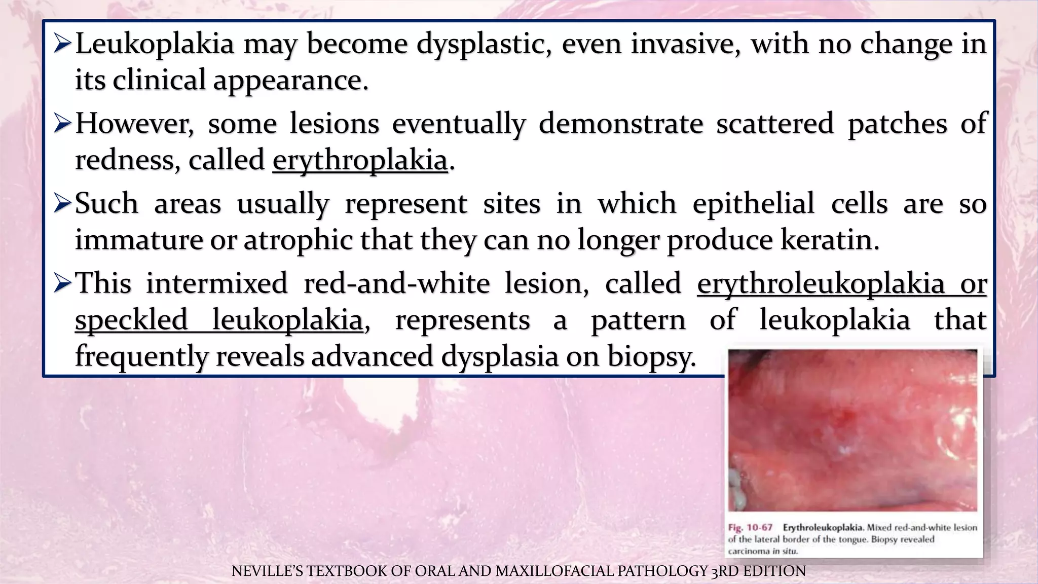 Leukoplakia case presentation | PPTX