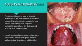 Leukoplakia | PPTX