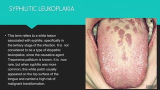 Leukoplakia | PPTX