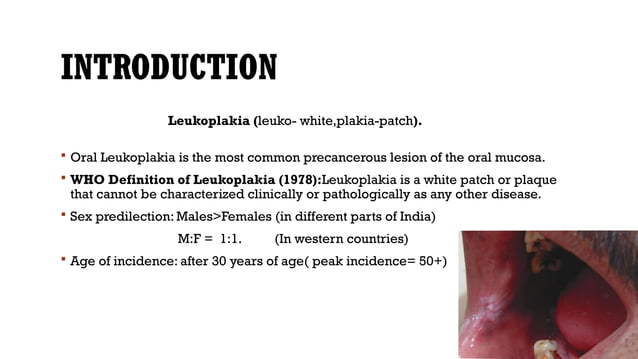 leukoplakia, oral medicine and pathology, BDS | PPTX