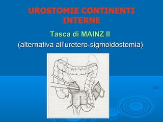 Le urostomie: seconda parte | PPT