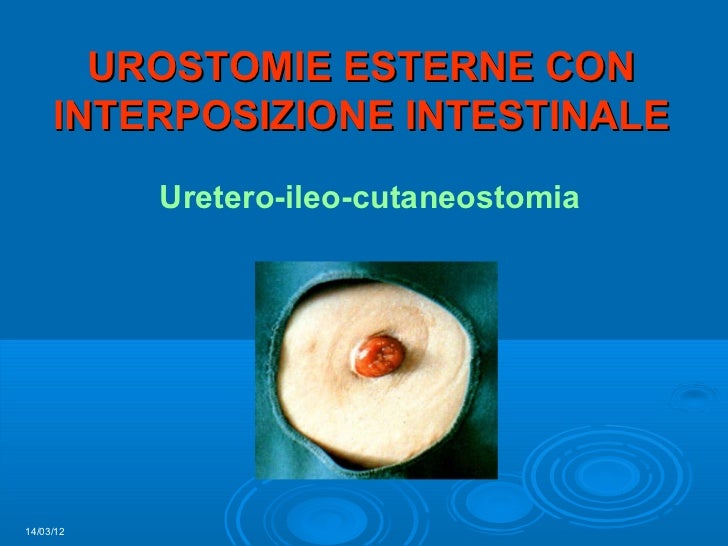 Le urostomie: seconda parte