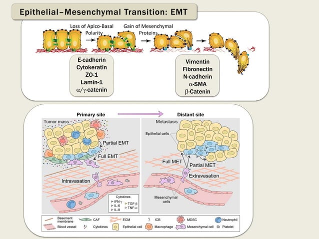 Professor Sima Lev: Epithelial–Mesenchymal Transition: EMT | PPT