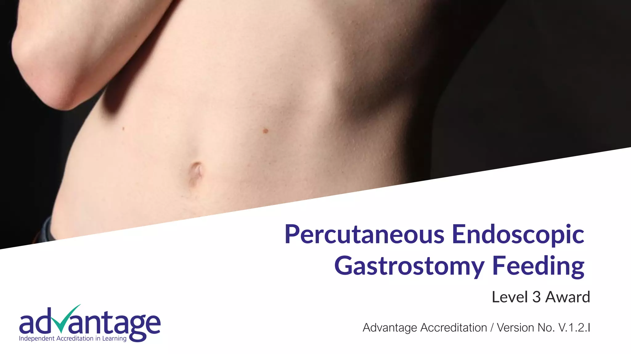 Level 3 Award in PEG Feeding | PDF | Digestive Disorders | Diseases and ...