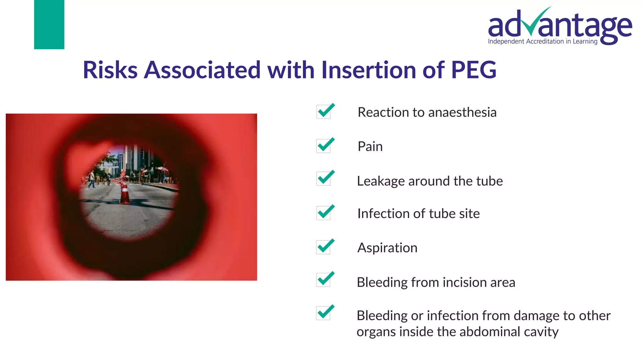 Level 3 Award in PEG Feeding | PDF