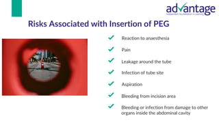 Level 3 Award in PEG Feeding | PDF